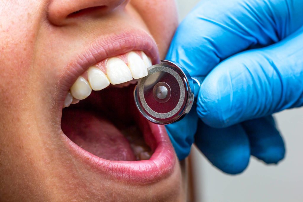 Disc Safety Guard 220mm - Dental Diamond IPR Discs - Strauss Diamond