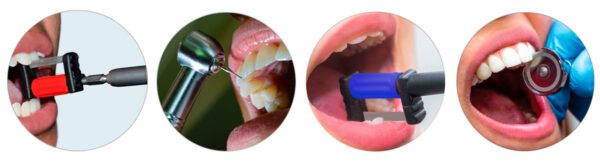 Interproximal Reduction (IPR) Dental Tools - IPR Disks, Strips, & Burs